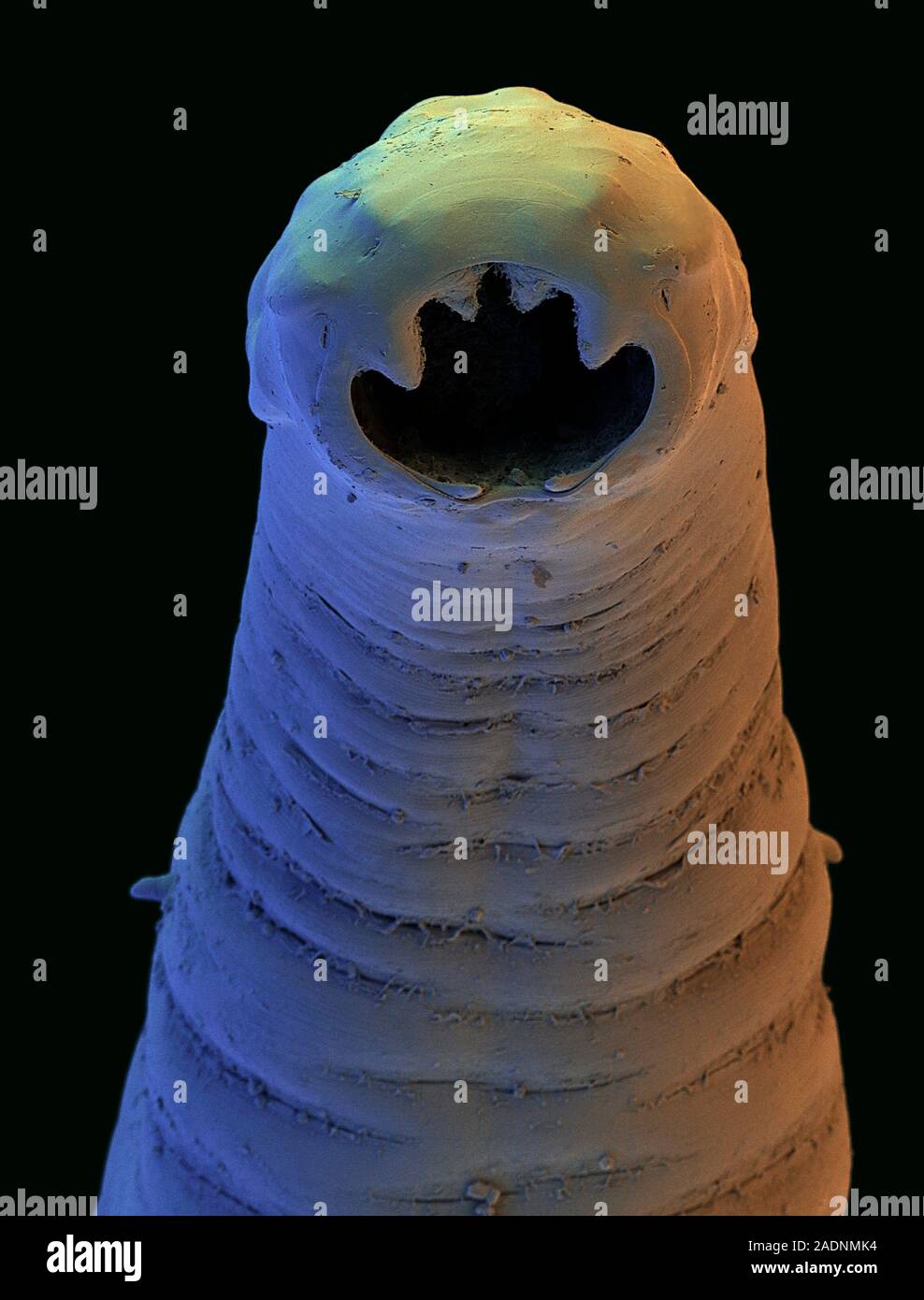 Hookworm head. Coloured Scanning Electron Micrograph of the head of the ...
