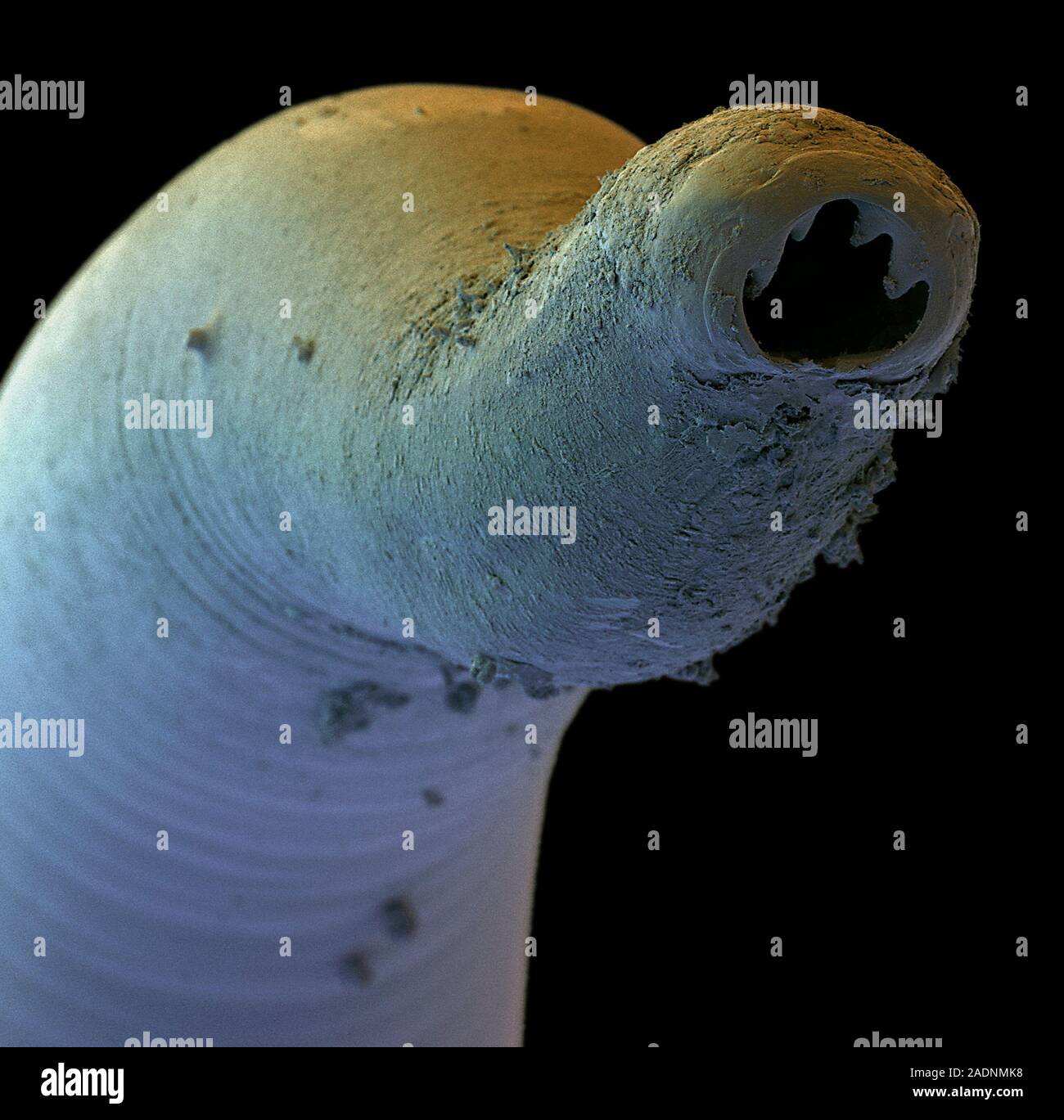 Hookworm head. Coloured Scanning Electron Micrograph of the head of the ...