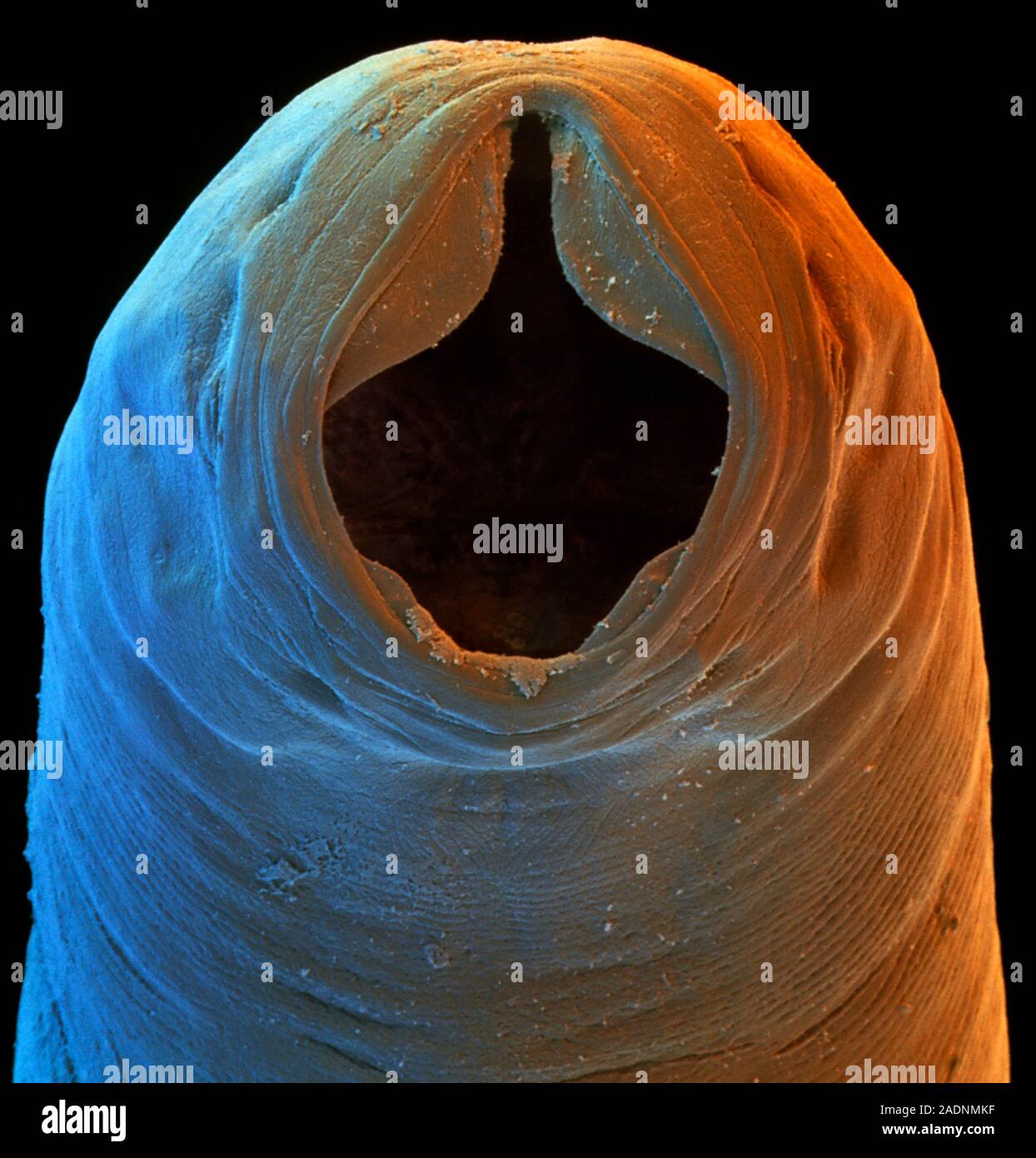 Hookworm head. Coloured Scanning Electron Micrograph of the head of the ...