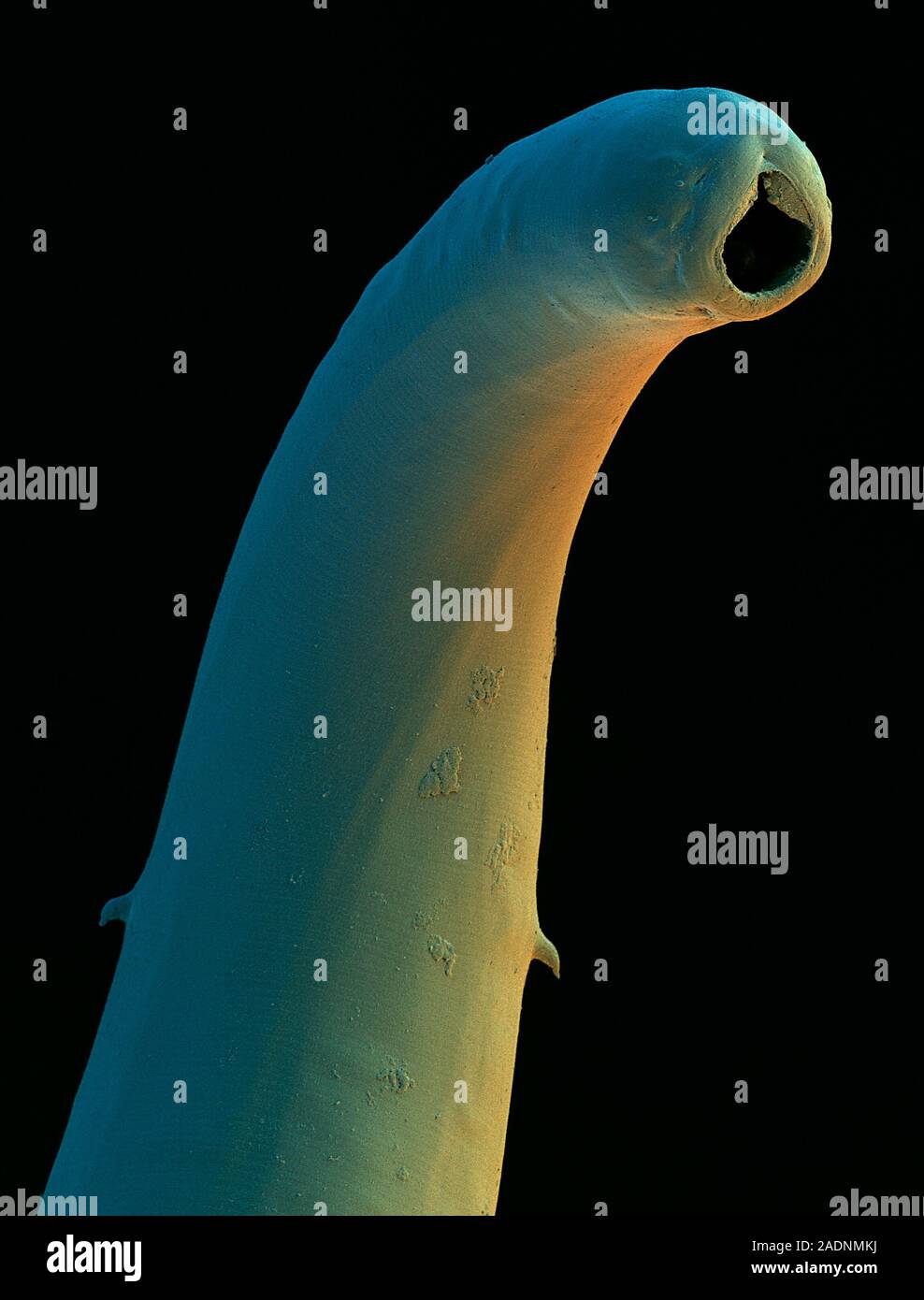 Hookworm head. Coloured Scanning Electron Micrograph of the head of the ...