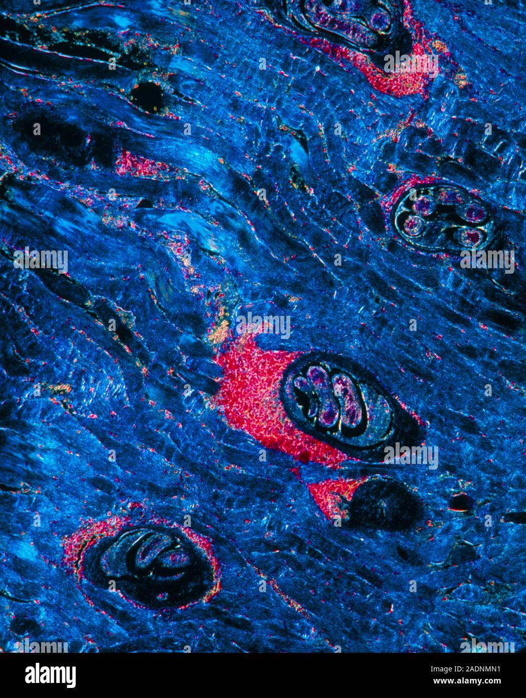 Trichinella spiralis. Light micrograph of a section through cysts ...