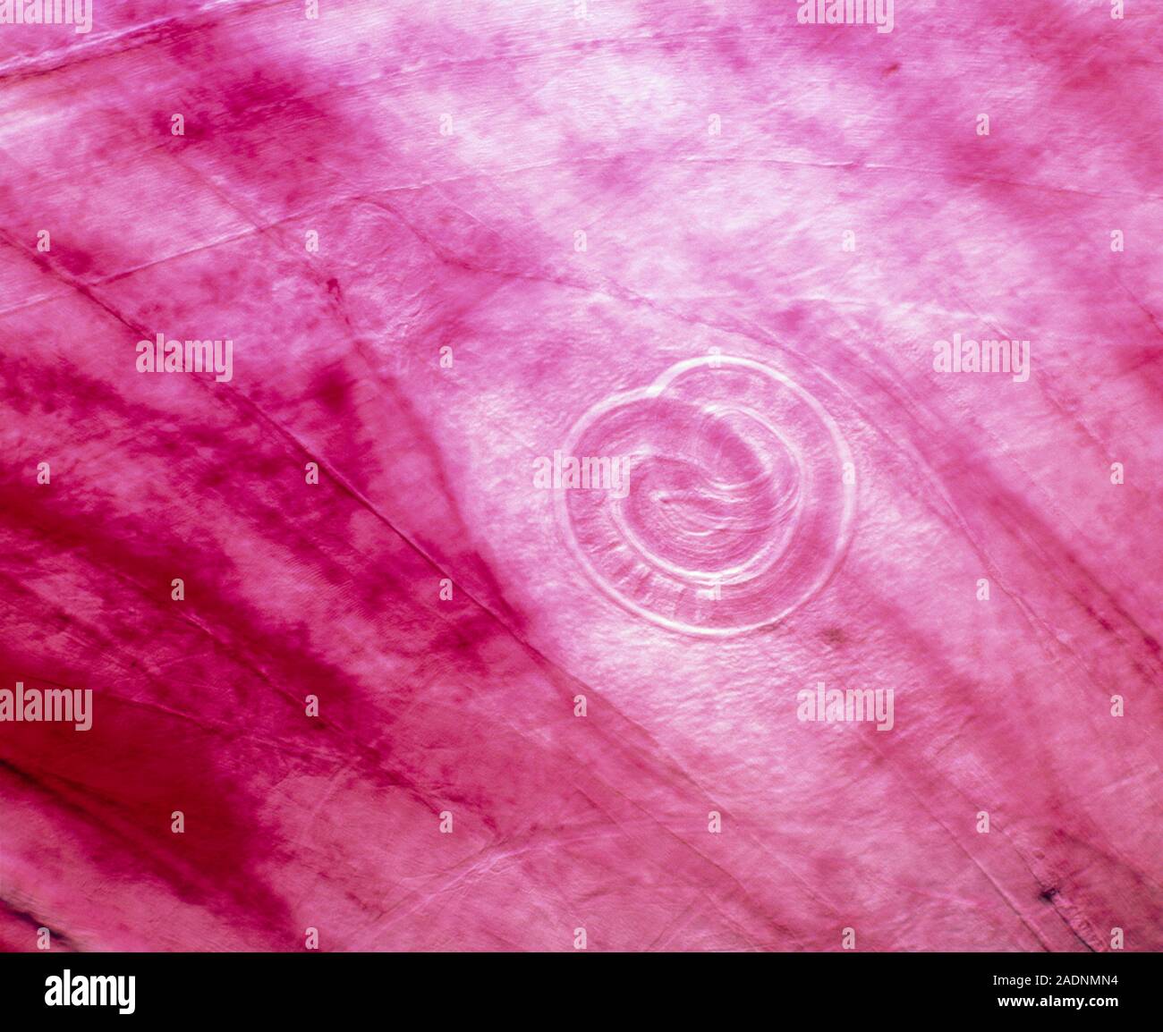 Trichinella roundworm. Light micrograph of a Trichinella spiralis ...