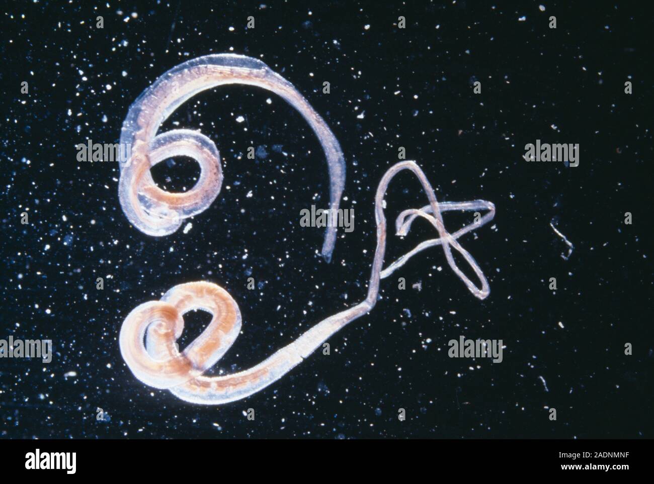 Trichuris Trichiura Rotulado