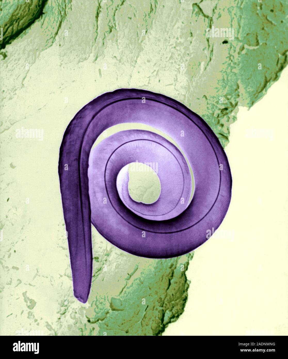 Nematode worm, coloured scanning electron micrograph (SEM). Nematode ...