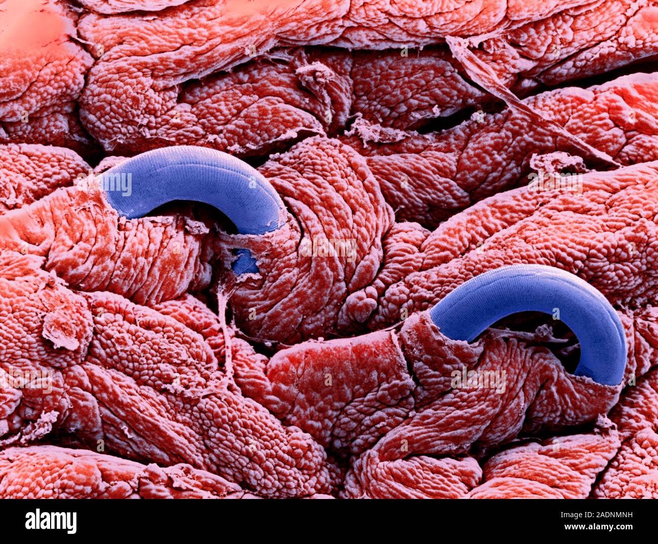 Threadworms In Intestine Coloured Scanning Electron Micrograph Sem Of Two Threadworms