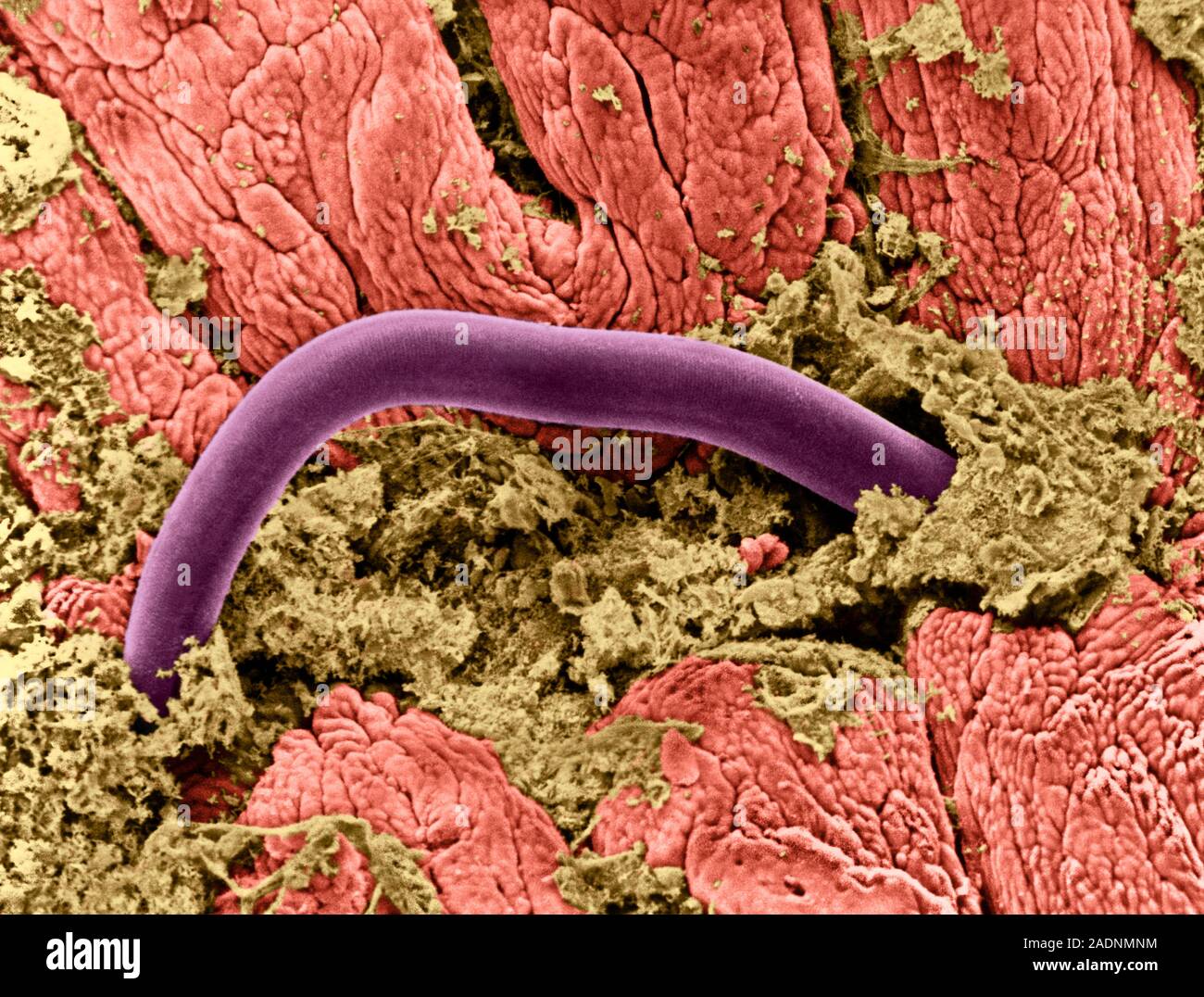 Threadworm In Intestine Coloured Scanning Electron Micrograph Sem Of A Threadworm