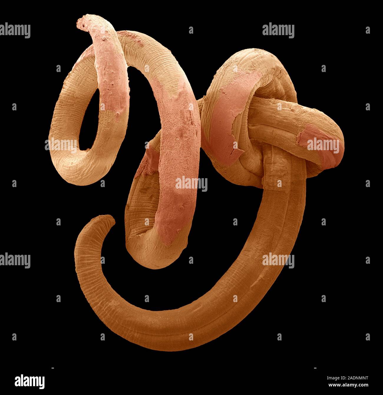 Threadworm, coloured scanning electron micrograph (SEM). This is a ...