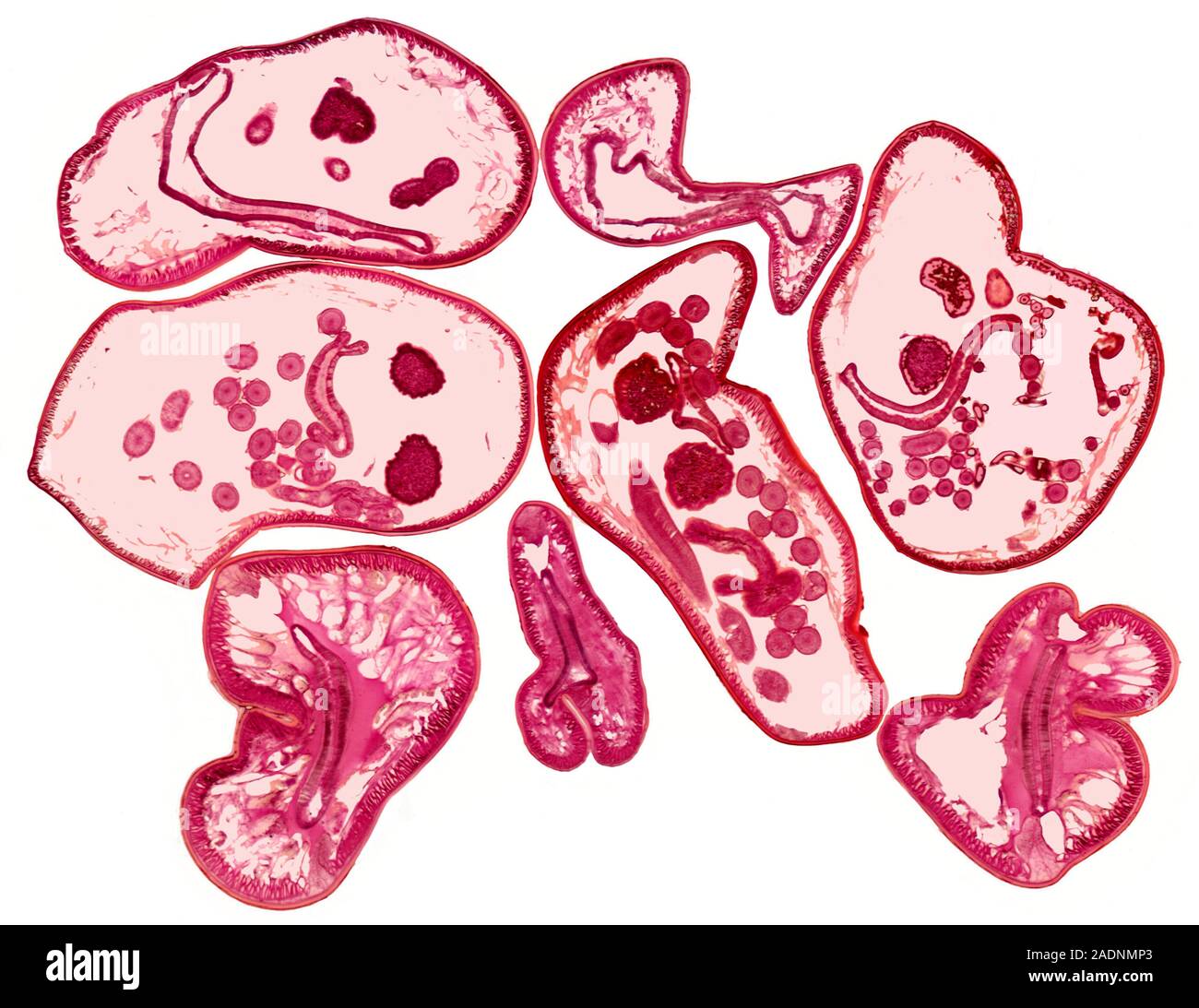 Roundworms. Light micrograph of cross-sections through various regions ...