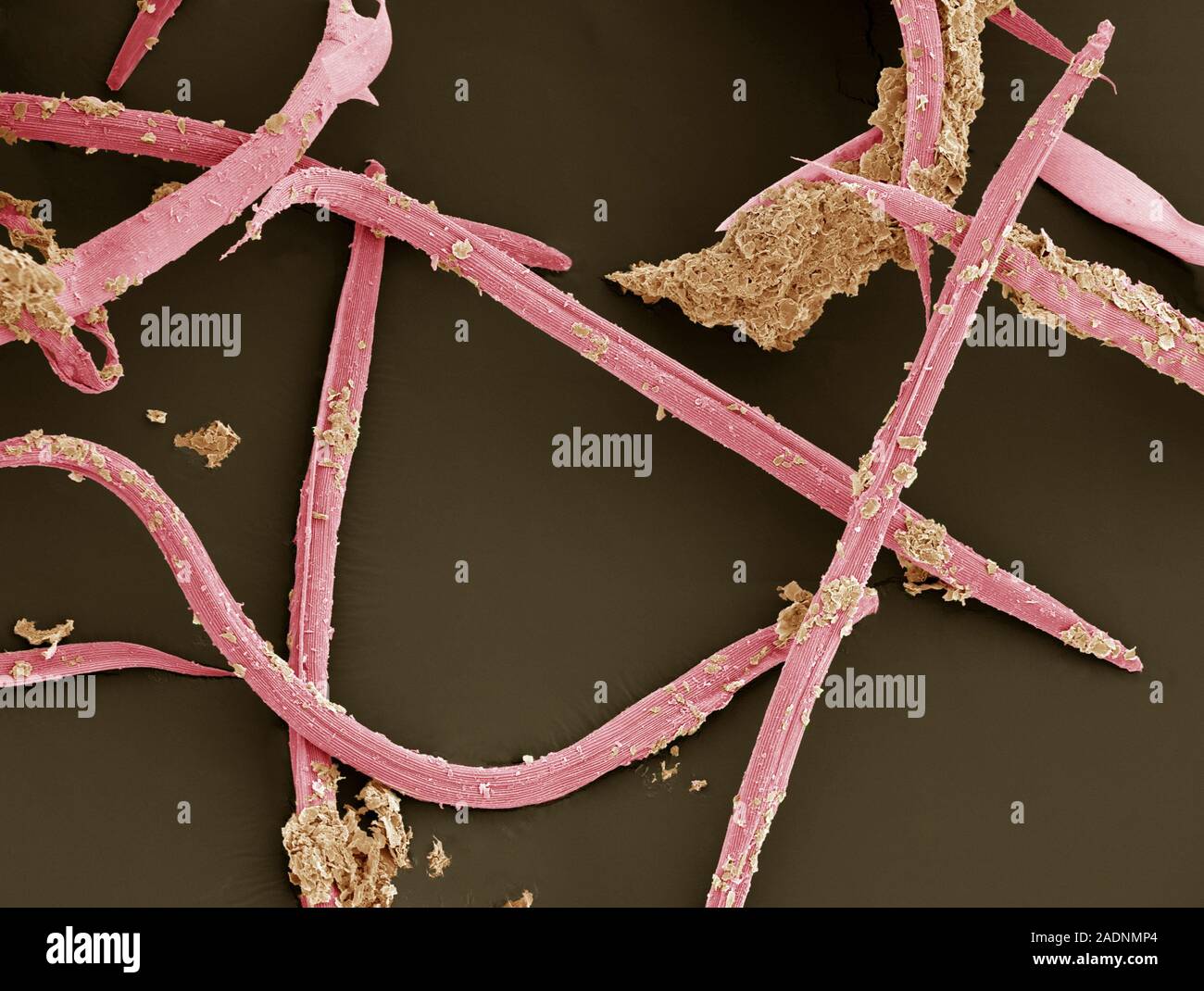 Nematode worms. Scanning electron micrograph of Heterorhabditis megidis ...