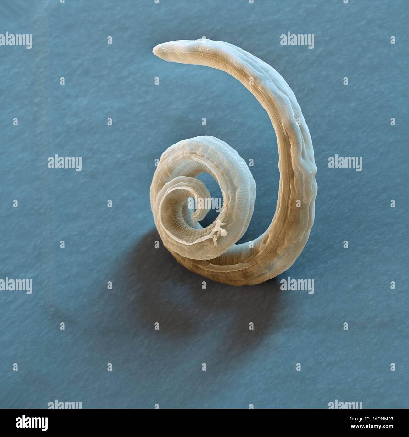 Dog lungworm (Angiostrongylus vasorum) adult, coloured scanning ...