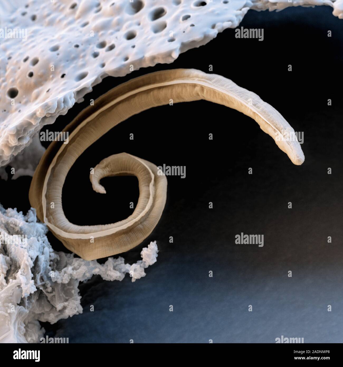 Dog lungworm (Angiostrongylus vasorum) adult, coloured scanning ...