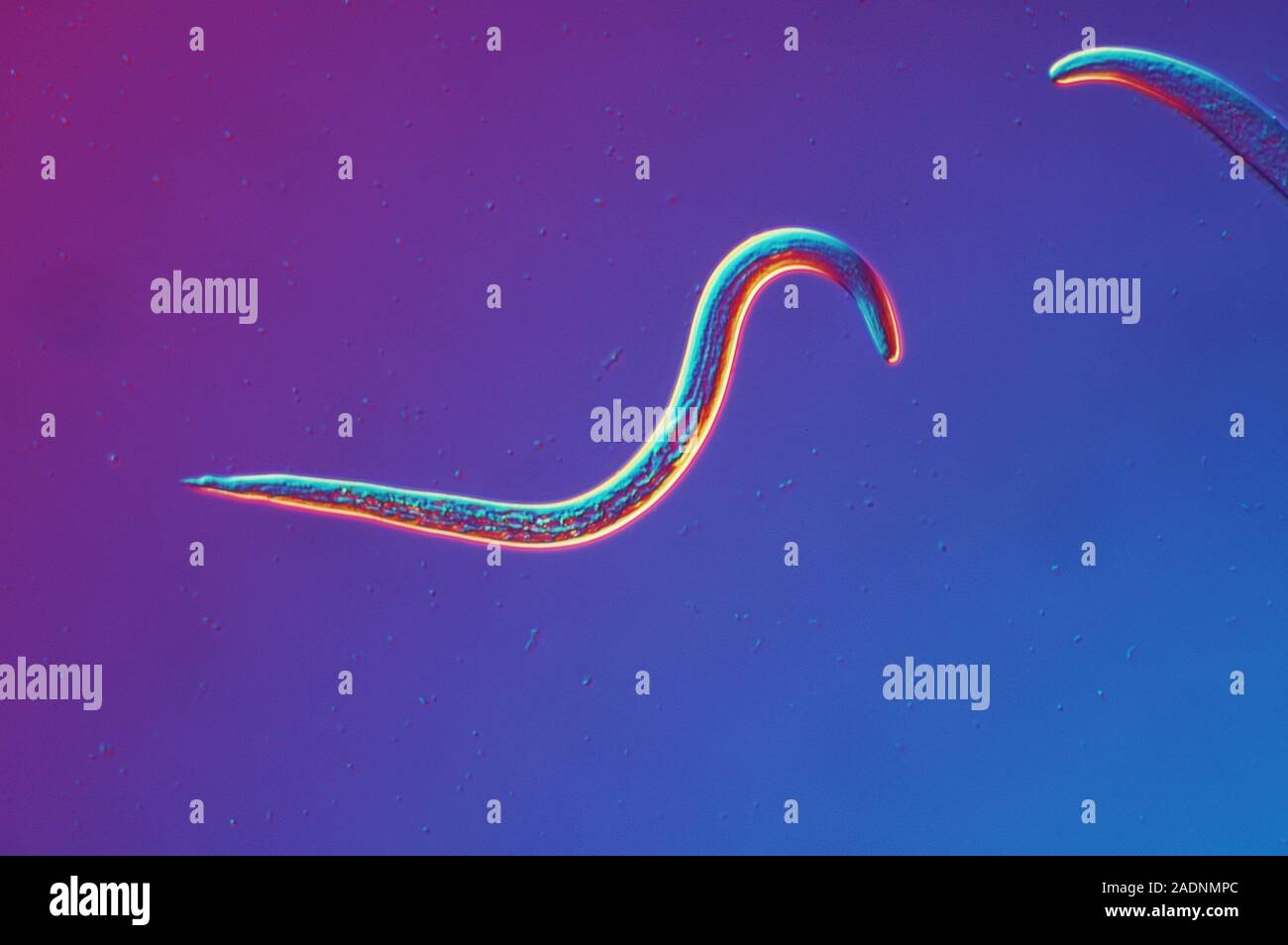 Dog lungworm (Angiostrongylus vasorum) larvae, light micrograph. This ...