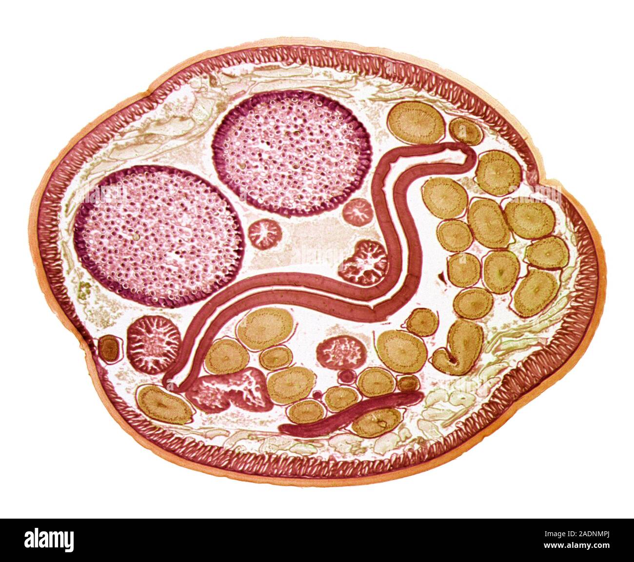 Parasitic roundworm. Light micrograph of a section through a female ...