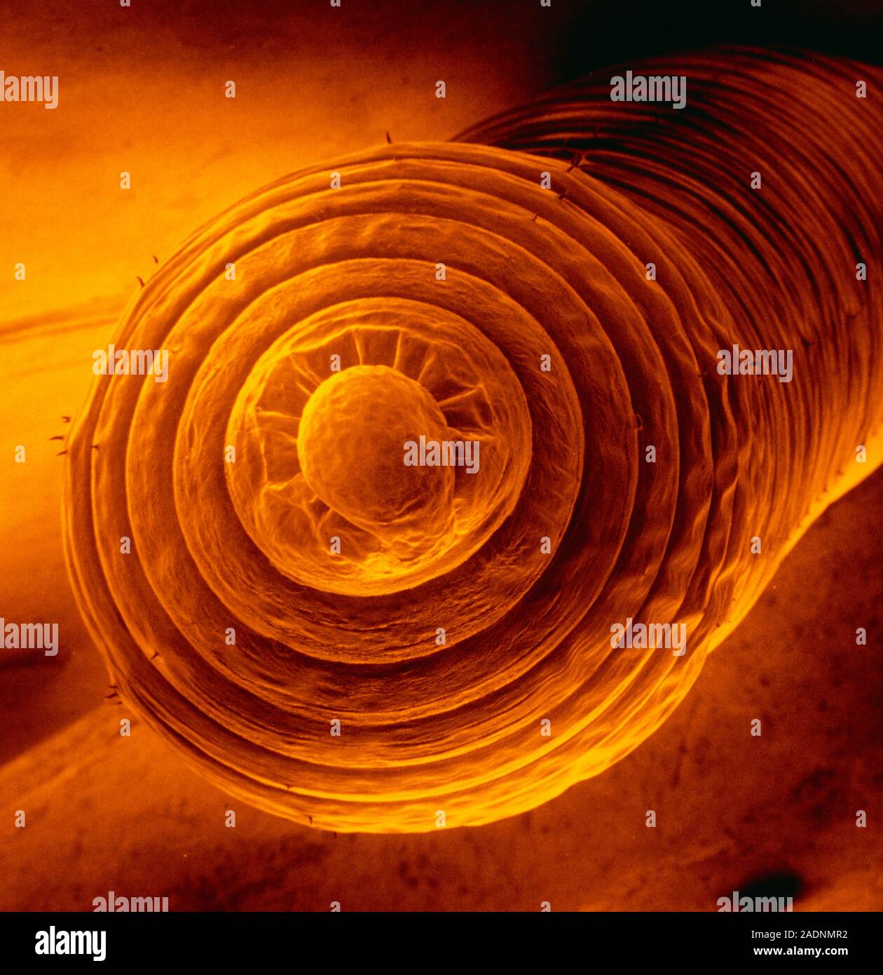 False colour scanning electron micrograph (SEM) of the head of an ...