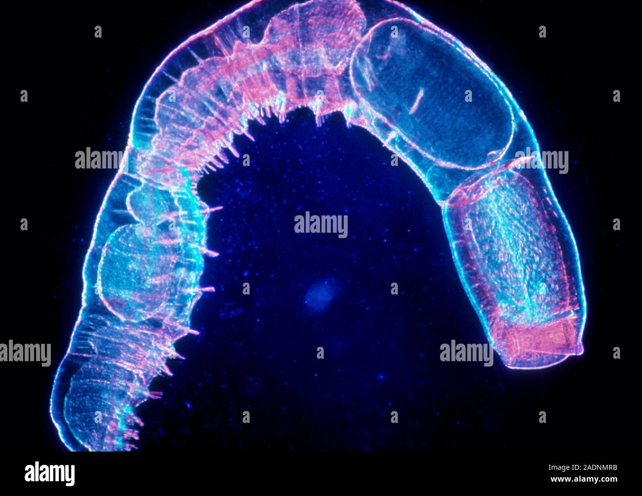Chaetogaster worm. Polarised light micrograph of the worm Chaetogaster ...