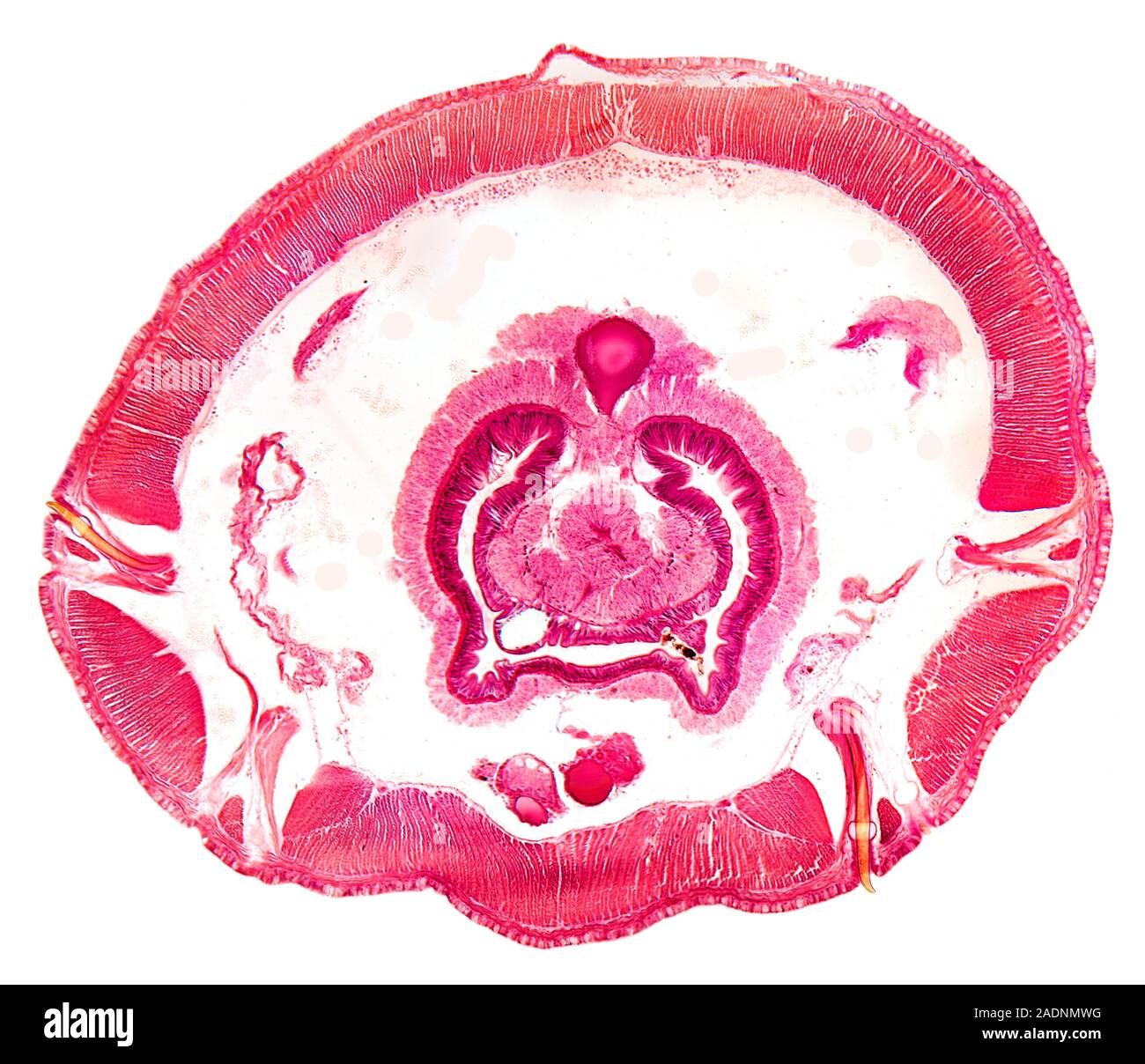 Lumbricus Terrestris Microscope