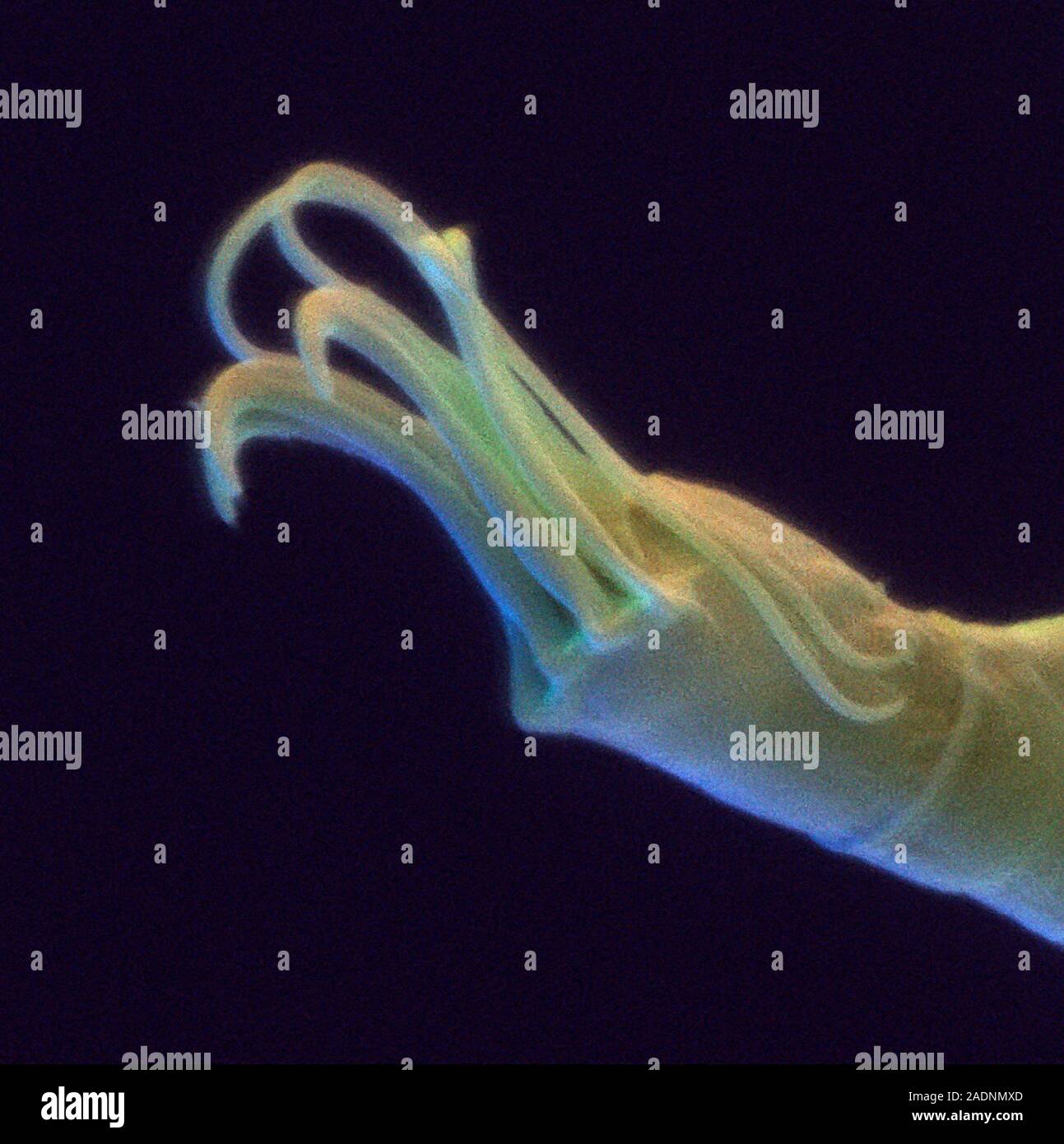Claws on leg of a tardigrade. Coloured Scanning Electron Micrograph ...
