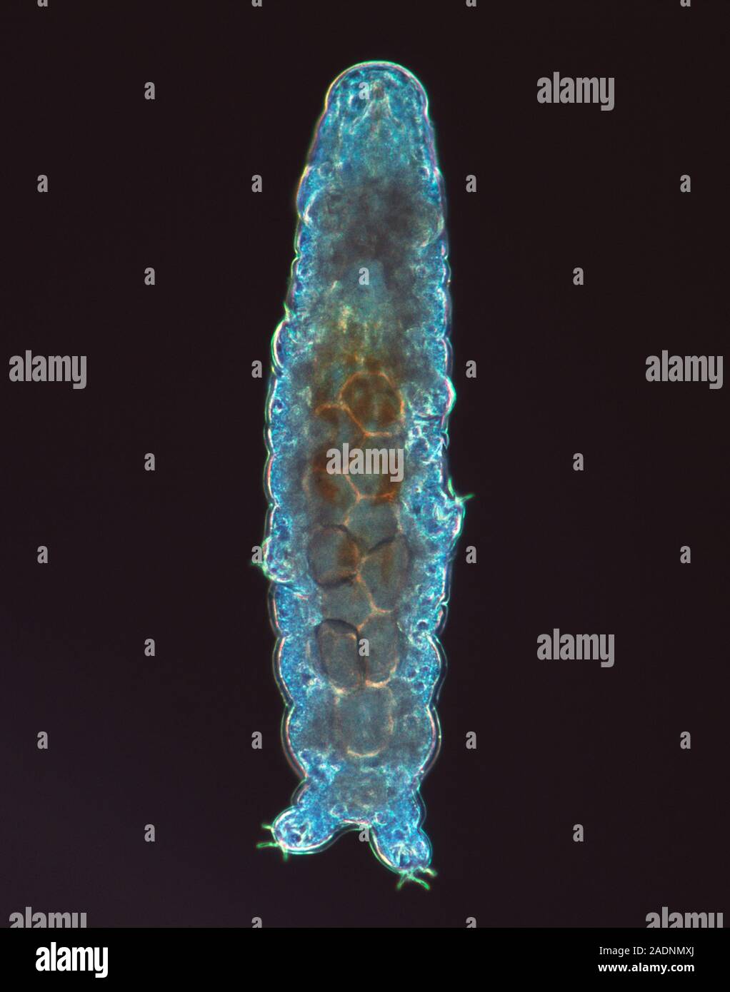 Water bear. Light micrograph of a water bear (phylum Tardigrada). This ...