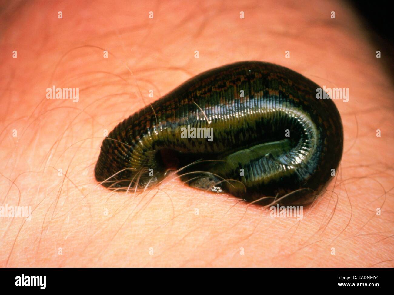 Leech. Close-up photograph of a medicinal leech, Hirudo medicinalis ...