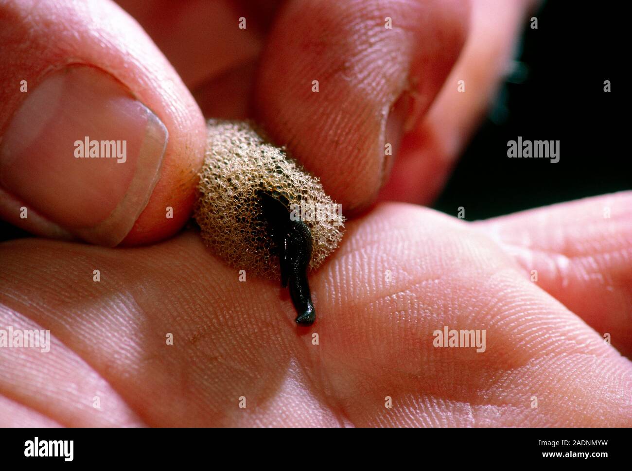 Leech cocoon. Person assists the release of young medicinal leeches ...