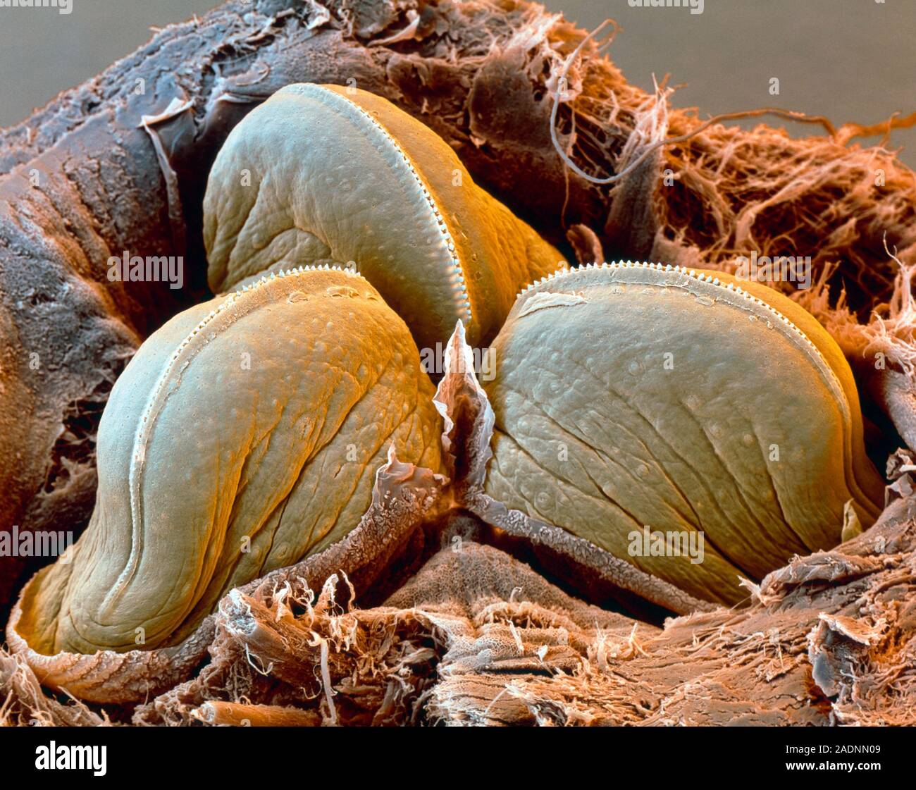 Leech mouth. Coloured scanning electron micrograph (SEM) of the ...