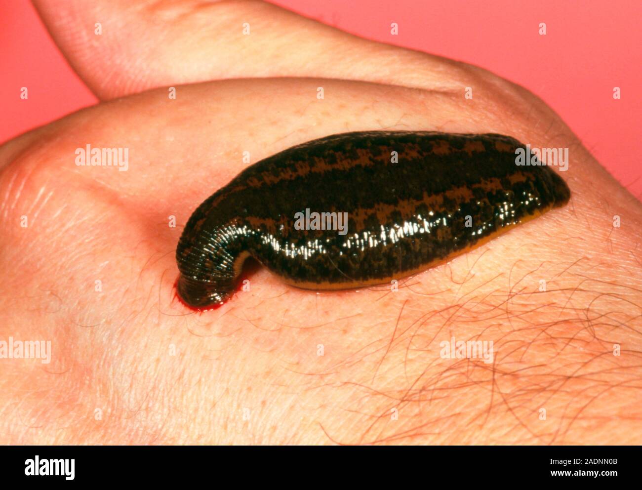 Leech. Medicinal leech (Hirudo medicinalis) feeding on a human hand ...
