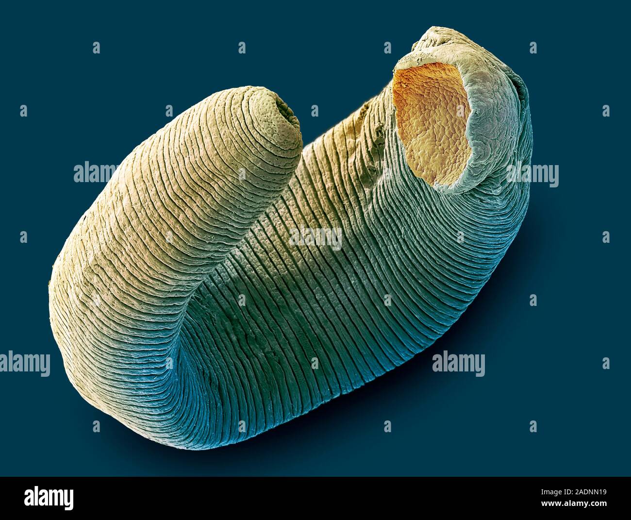 Freshwater leech. Coloured scanning electron micrograph (SEM) of a ...