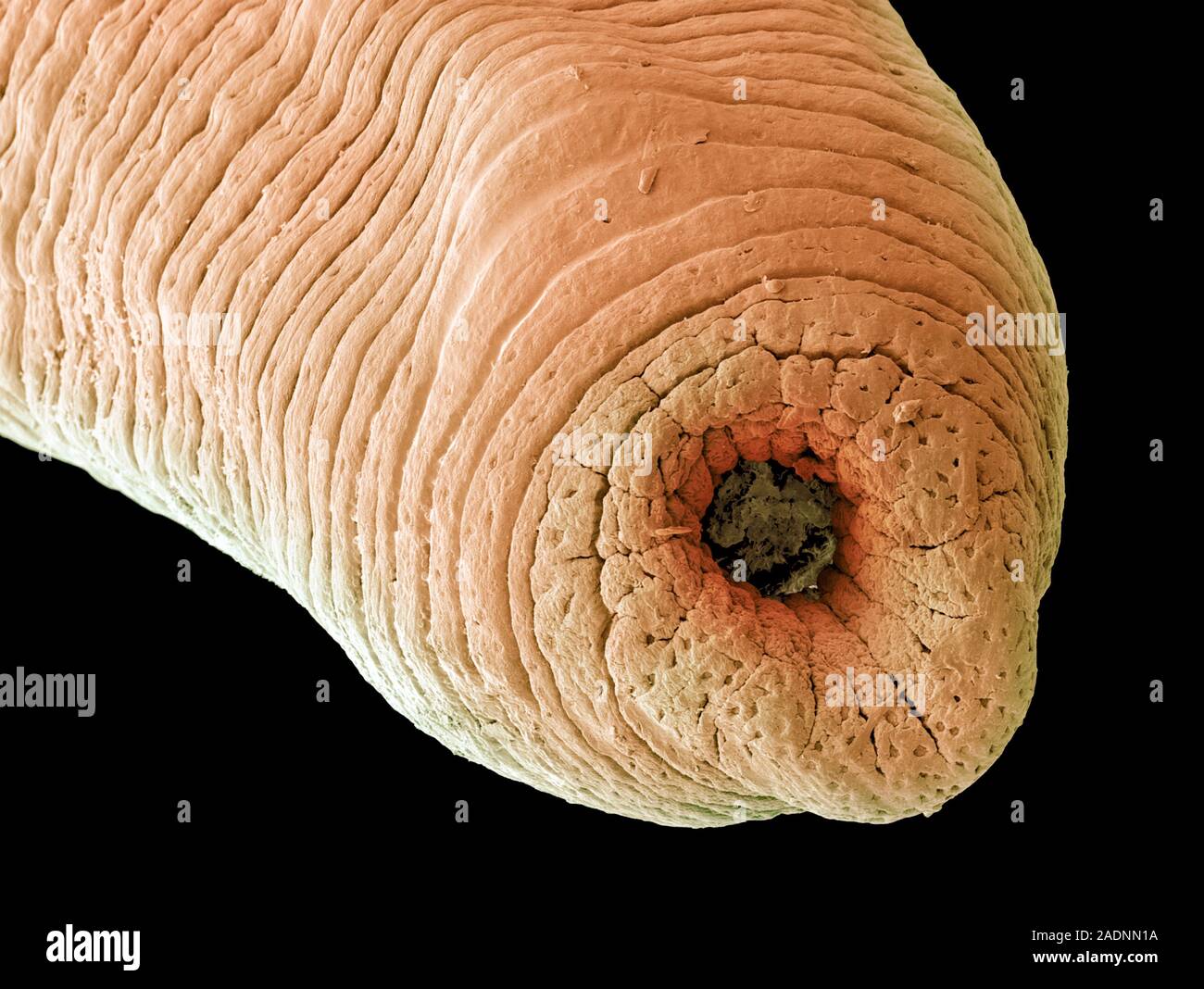 Freshwater leech's head sucker. Coloured scanning electron micrograph ...