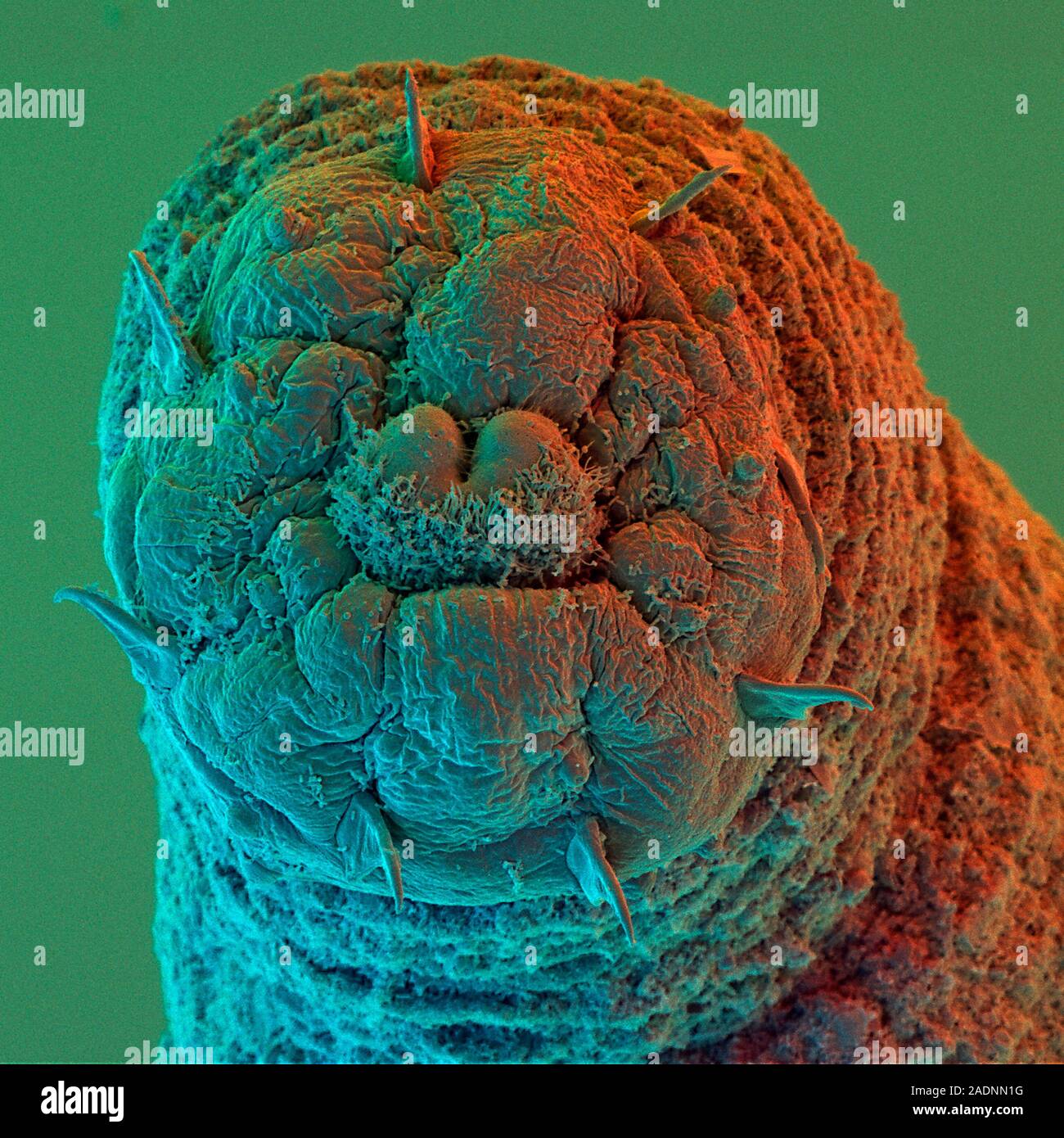 Mouth of a peanut worm. Coloured Scanning Electron Micrograph (SEM) of ...