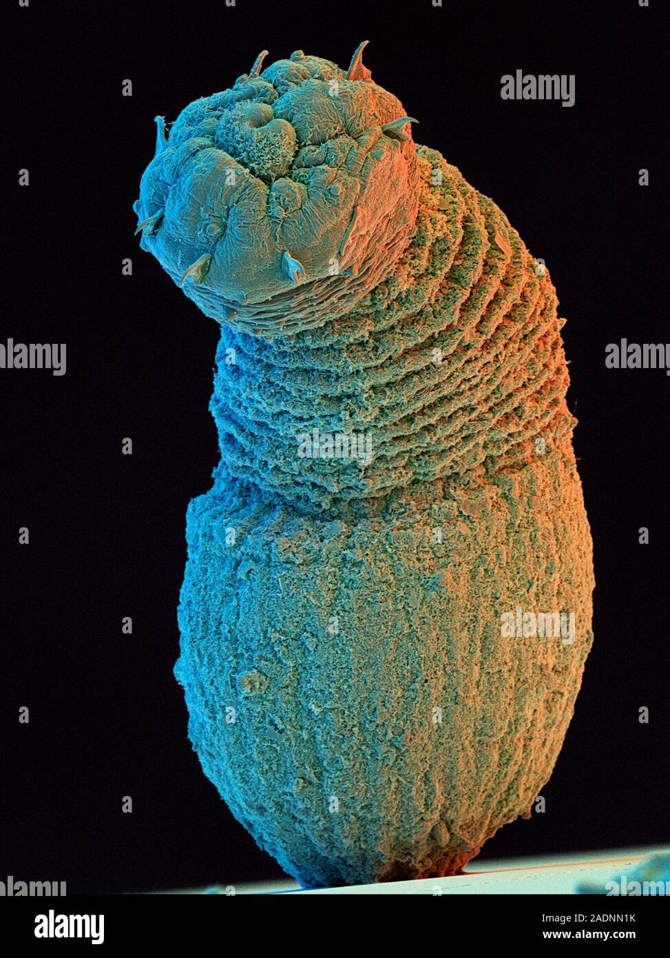 Peanut worm. Coloured scanning electron micrograph (SEM) of a peanut ...
