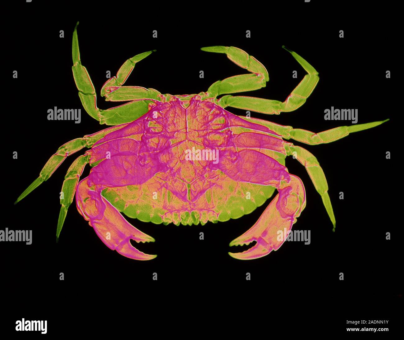 Edible crab. Coloured X-ray of the edible or rock crab Cancer pagurus ...