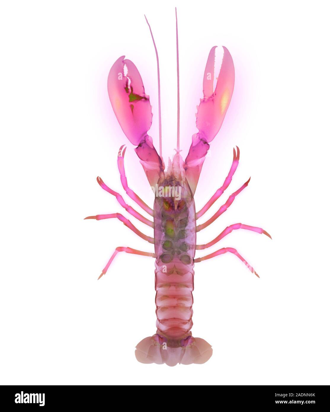Lobster. Coloured X-ray of a lobster (order Decapoda). This marine ...
