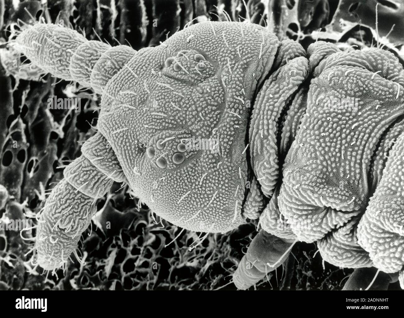 Scanning electron micrograph of the head of an unidentified species of ...