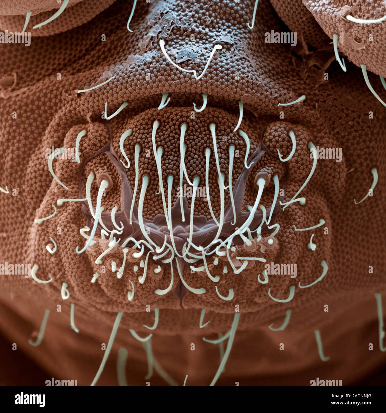 Springtail mouth. Coloured scanning electron micrograph (SEM) of the ...