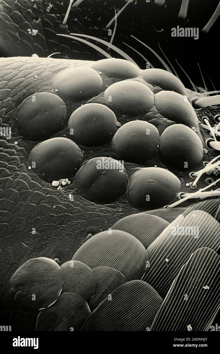 Scanning electron micrograph of the small compound eye of a silverfish ...