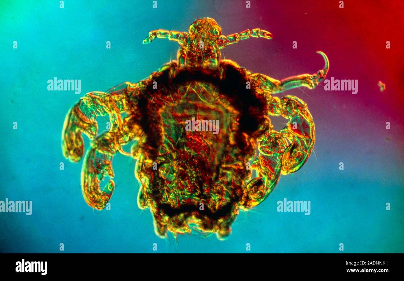 Light micrograph of the crab (or pubic) louse, Phthirus pubis, that ...