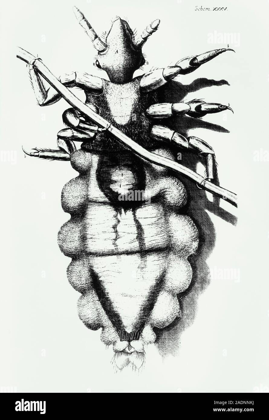Human louse clinging to a hair, drawn by English scientist Robert Hooke ...