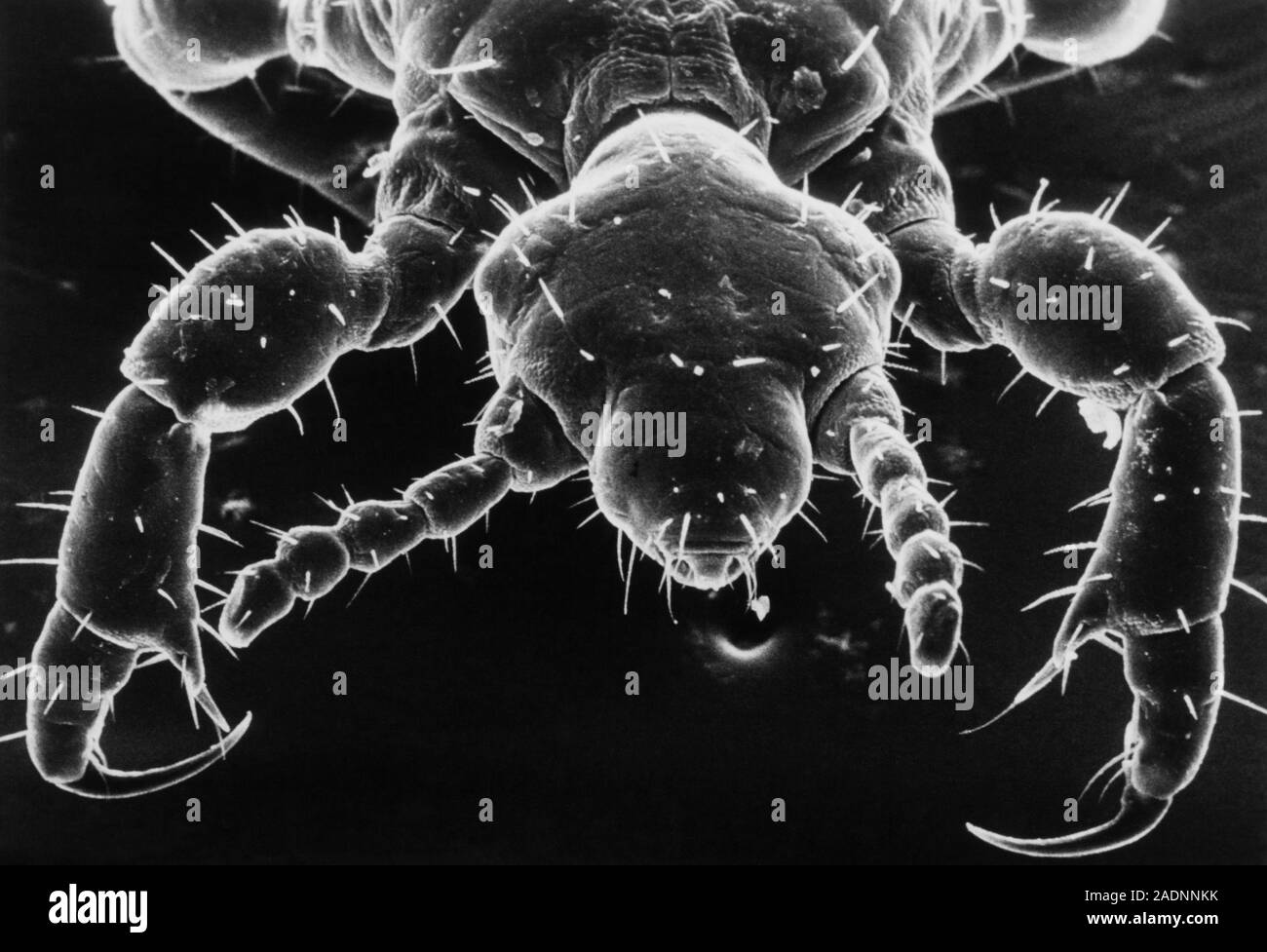 Scanning electron micrograph (SEM) of the human body louse, Pediculus ...