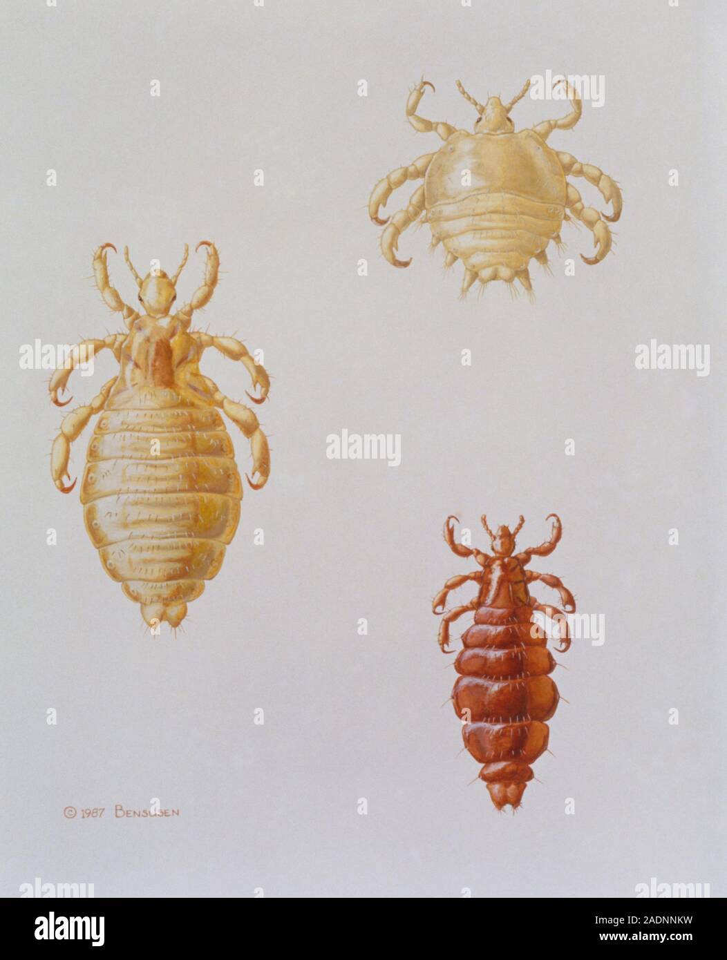 Illustration Showing The Three Types Of Human Louse At Top Right Is The Crab Or Pubic Louse