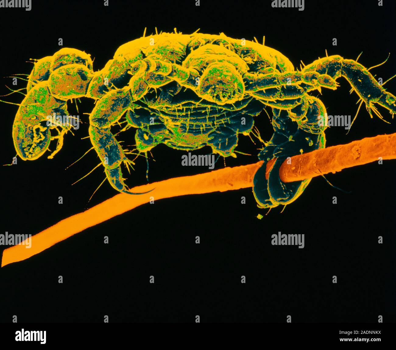 False-colour scanning electron micrograph (SEM) of the pubic louse ...