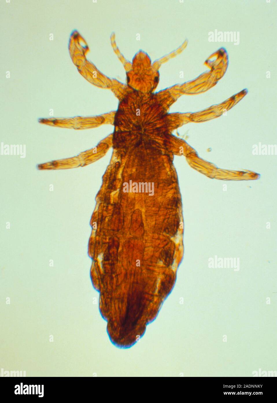 Light micrograph of the human head louse, Pediculus humanus capitis. P ...