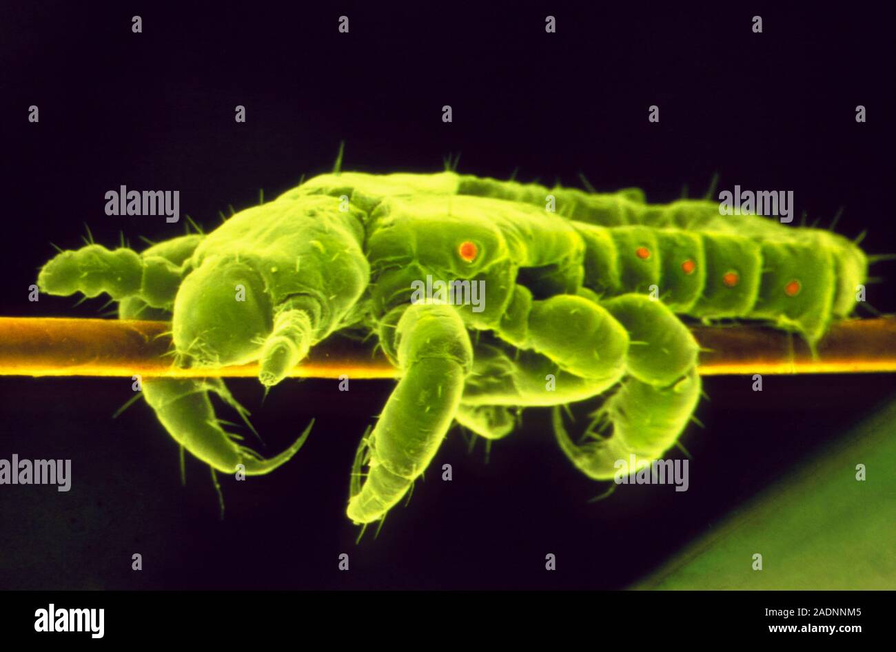 False-colour scanning electron micrograph (SEM) of a human head louse ...