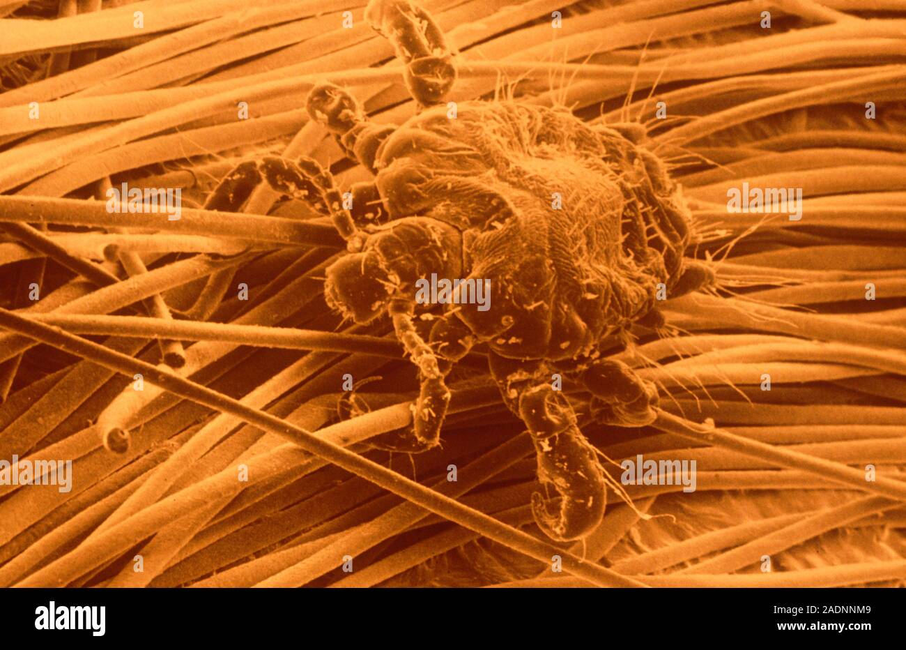 False-colour scanning electron micrograph (SEM) of the pubic louse ...