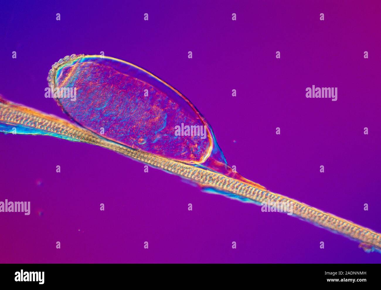 Light micrograph of a nit (egg case) containing a developing human head ...