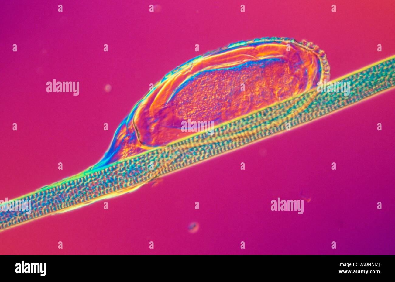 Light micrograph of a nit (egg case) containing a developing human head ...