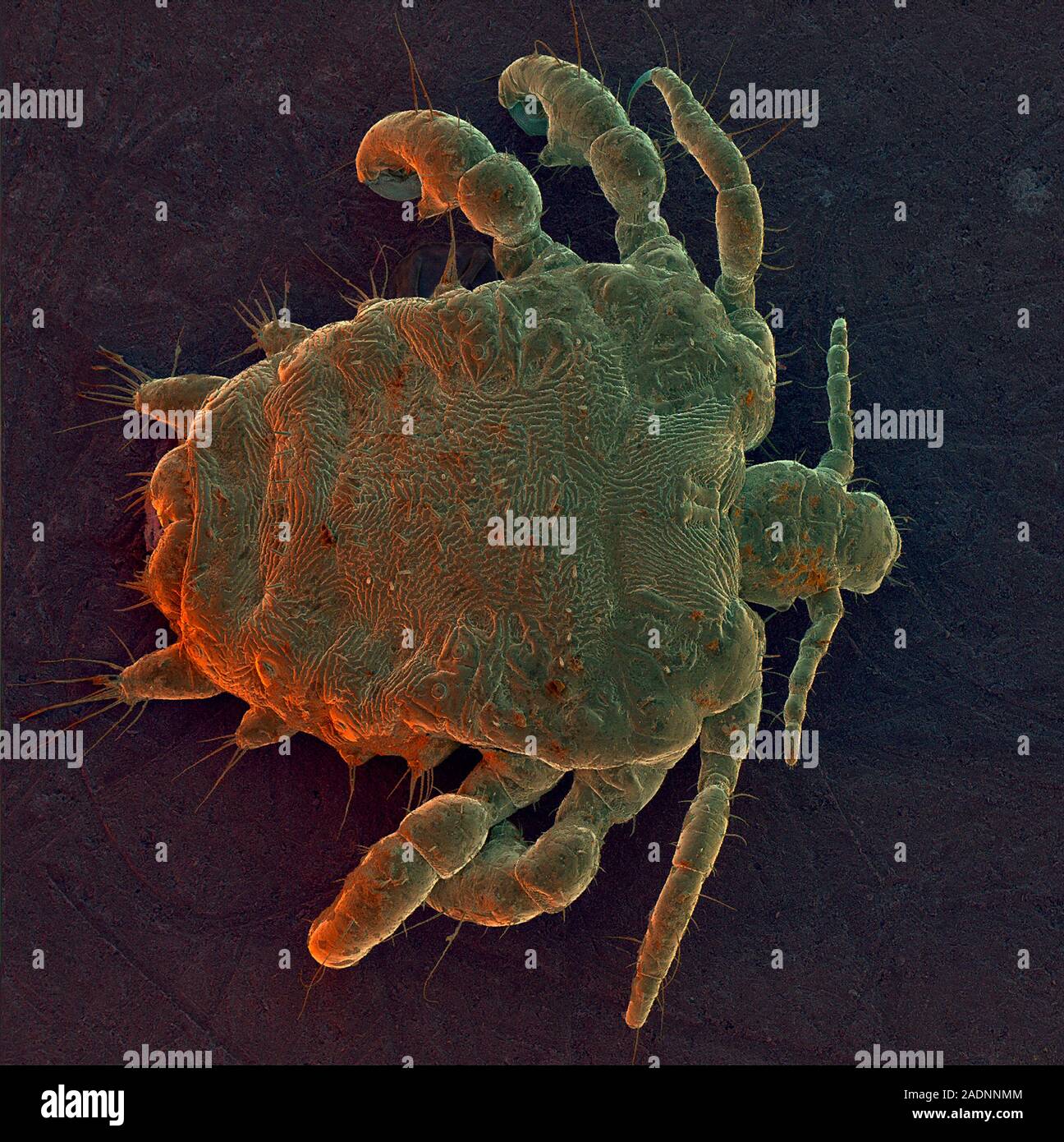 Crab louse. Coloured Scanning Electron Micrograph (SEM) of the crab ...
