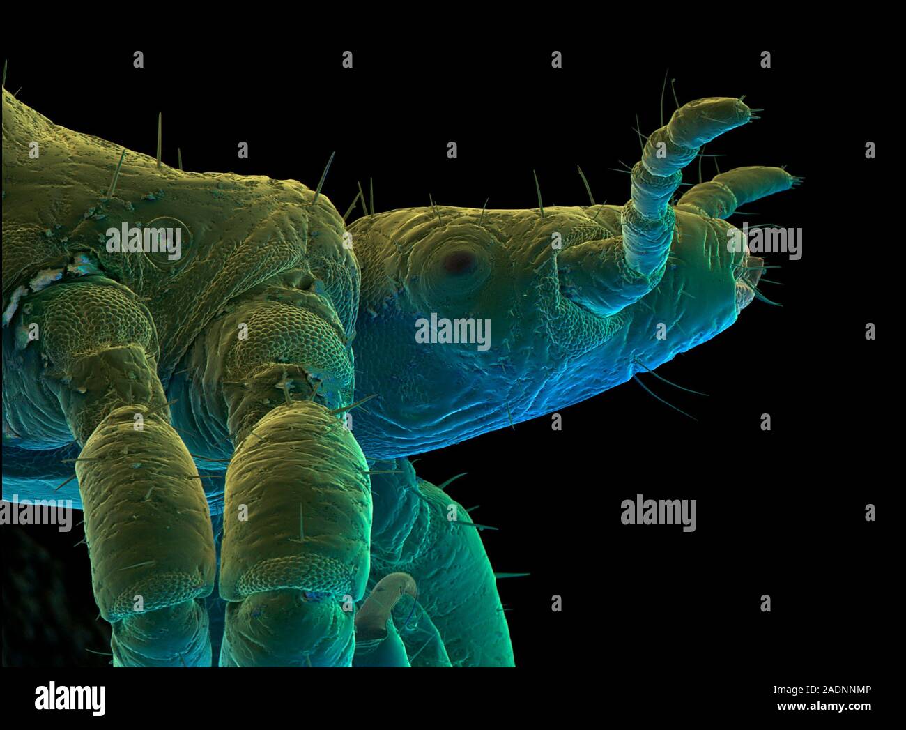 Body louse. Coloured Scanning Electron Micrograph (SEM) of the blood ...