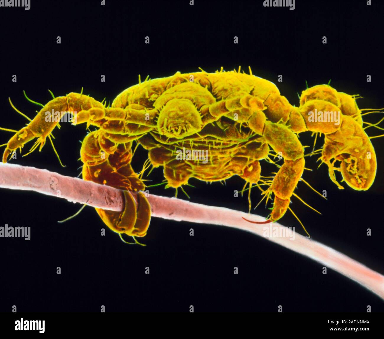 Pubic louse. Coloured Scanning Electron Micrograph (SEM) of a pubic ...