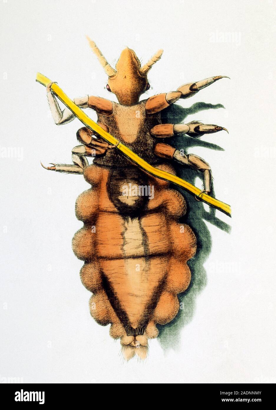Louse. Human louse clinging to a hair, drawn by Robert Hooke and ...