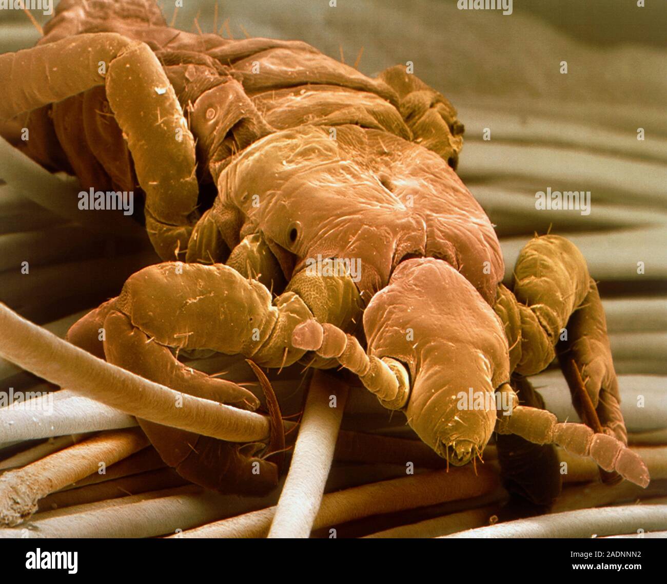 Head louse. Scanning electron micrograph (SEM) of a human head louse ...